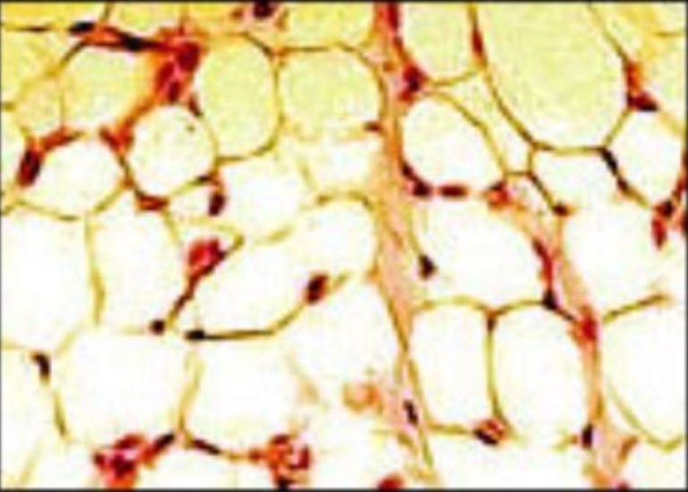 Bindegewebe: Histologie (Arten, Aufbau, Funktion) | Lecturio