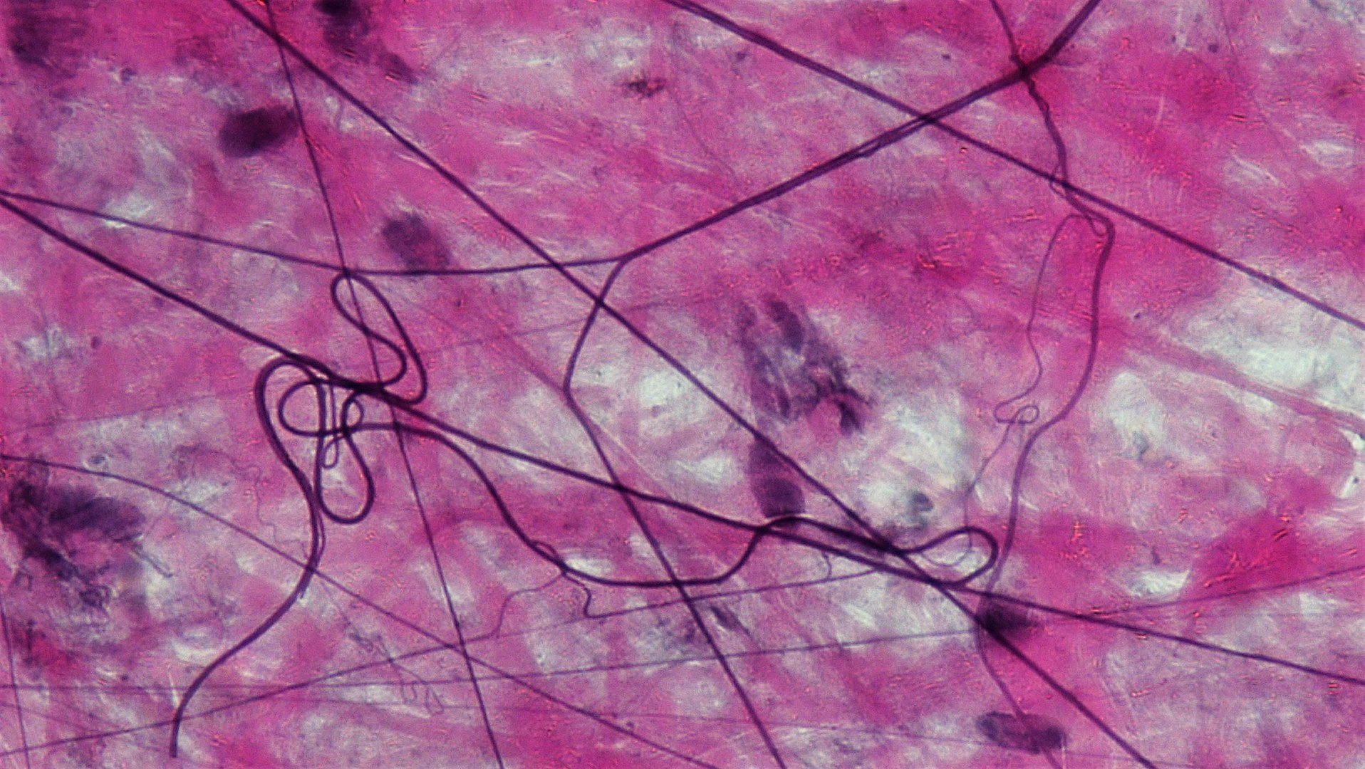 Bindegewebe: Histologie (Arten, Aufbau, Funktion) | Lecturio