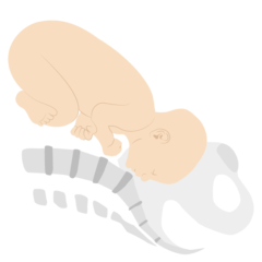 Fehlstellungen des Kindes im Geburtskanal - E-Learning mit Lecturio