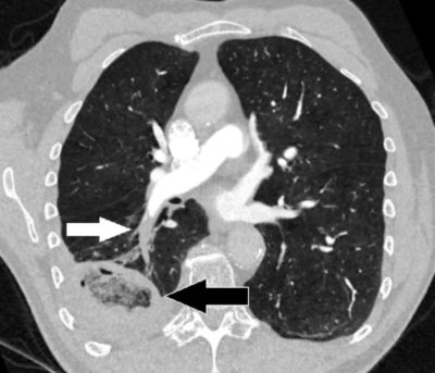 CT (Computertomografie): bildgebende Verfahren | Lecturio