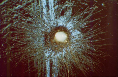 Candida/Candidose: Infektion & Therapie | Lecturio