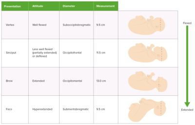 Fehlstellungen des Kindes im Geburtskanal - E-Learning mit Lecturio
