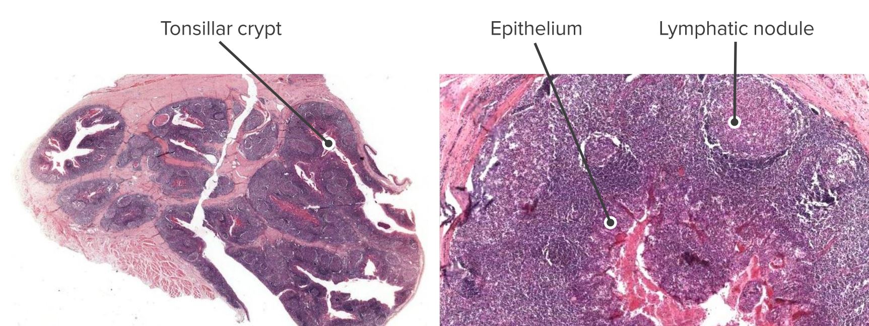 Sekundäre lymphatische Organe: Überblick & Funktion | Lecturio