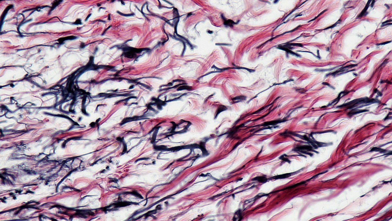 Bindegewebe: Histologie (Arten, Aufbau, Funktion) | Lecturio