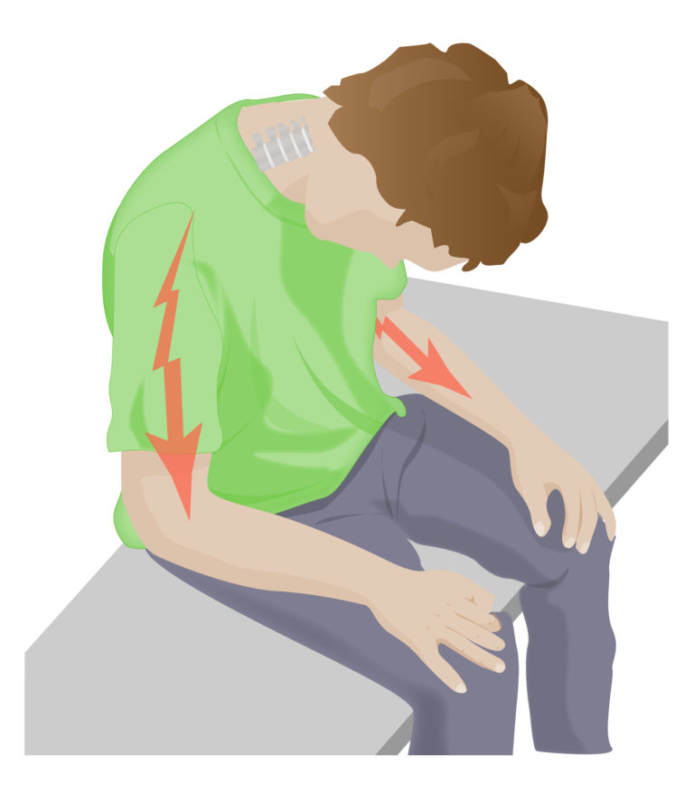 Nackenschmerzen: Ursachen & Therapie | Lecturio