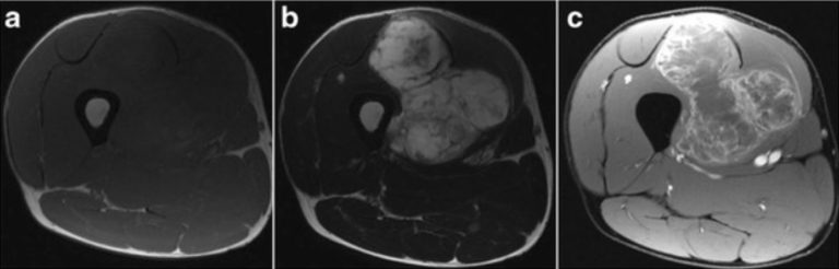 MRT (Magnetresonanztomografie): Bildgebung | Lecturio