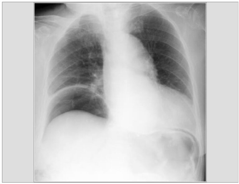 Bildgebung des Darms: Röntgen, Ultraschall, CT | Lecturio