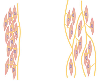 Muskelgewebe: 3 Arten, Aufbau & Funktion | Lecturio