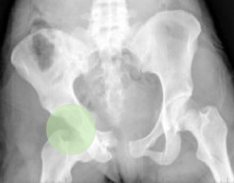 Beckenfrakturen - E-Learning mit Lecturio